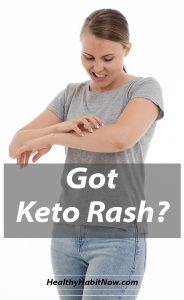 Got Keto Rash? Here's What It Is and What To Do - Healthy Habit Now
